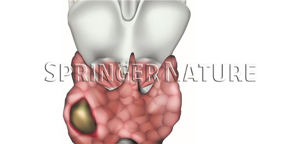 Medulläre Karzinome: Chancen mit neuen RET-Kinase-Inhibitoren