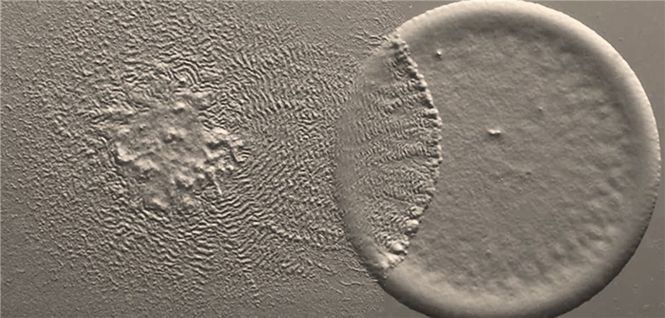 Myxococcus xanthus ist Mikrobe des Jahres 2020