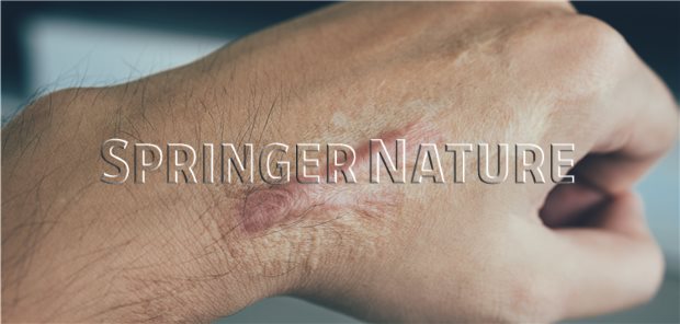 Neue Empfehlungen zu Keloid und hypertrophen Narben