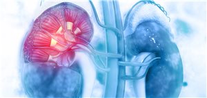 Erfolg mit Finerenon bei diabetischer Nierenerkrankung