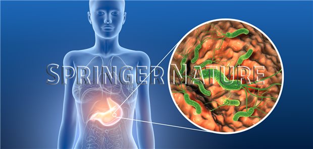 Bei ASS-Therapie und H.-pylori-Infektion beugen Antibiotika ...
