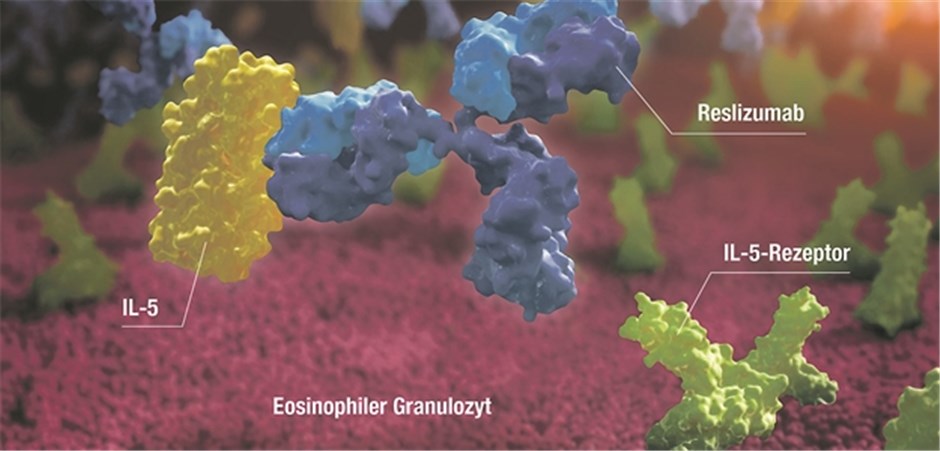 IL-5-Antikörper bei schwerem eosinophilem Asthma