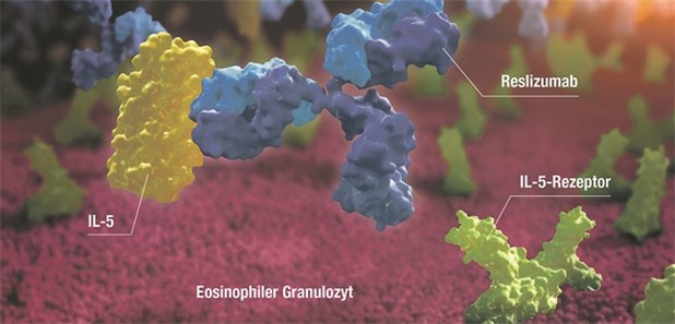 IL-5-Antikörper bei schwerem eosinophilem Asthma