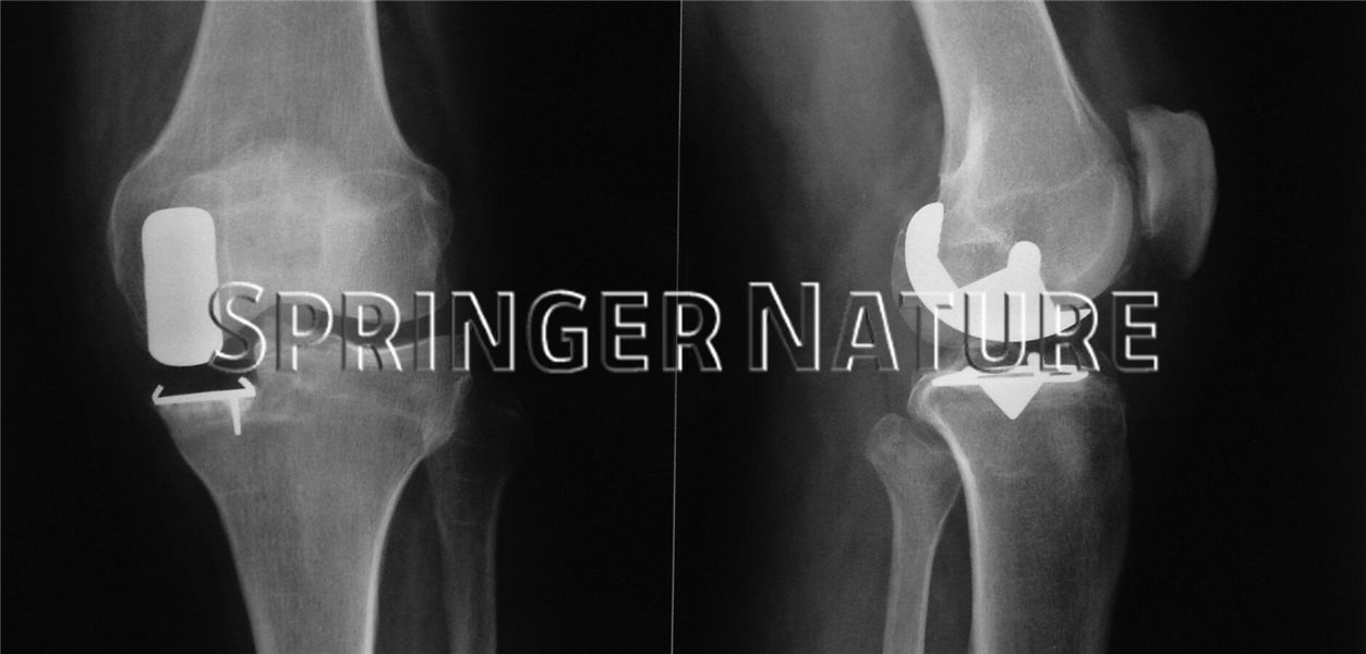 Knie-Teilprothese trotz erhöhtem Revisionsrisiko von Vorteil?