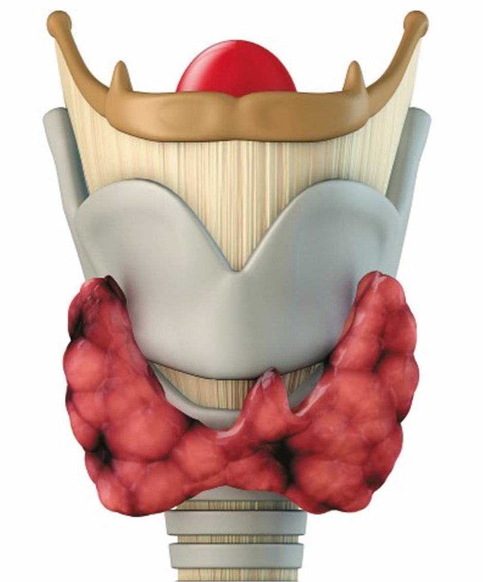 Neue Kombitherapie bei Struma nodosa