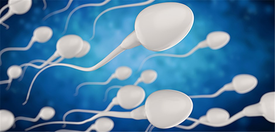 Ejakulatprobe geht auch zu Hause!