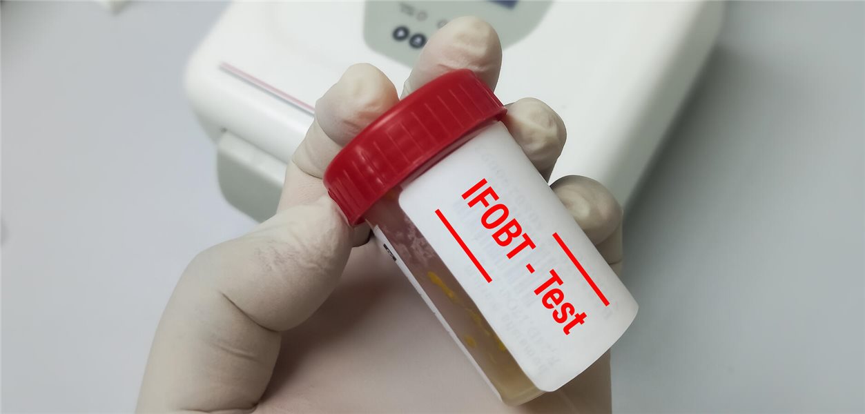 Niedrigere Darmkrebs-Mortalität nach iFOBT-Screening