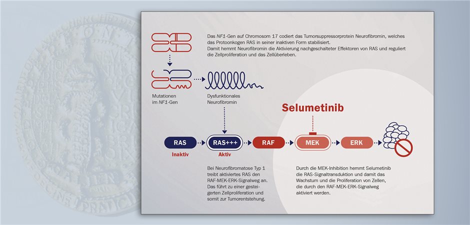 Koselugo – die erste Therapie bei inoperablen plexiformen Neurofibromen
