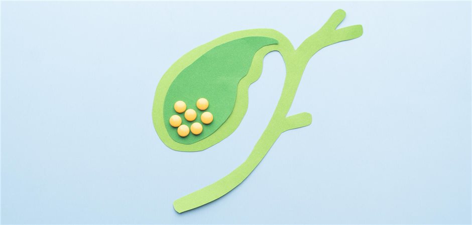 Diagnostik von Gallensteinen: So gehen Sie vor