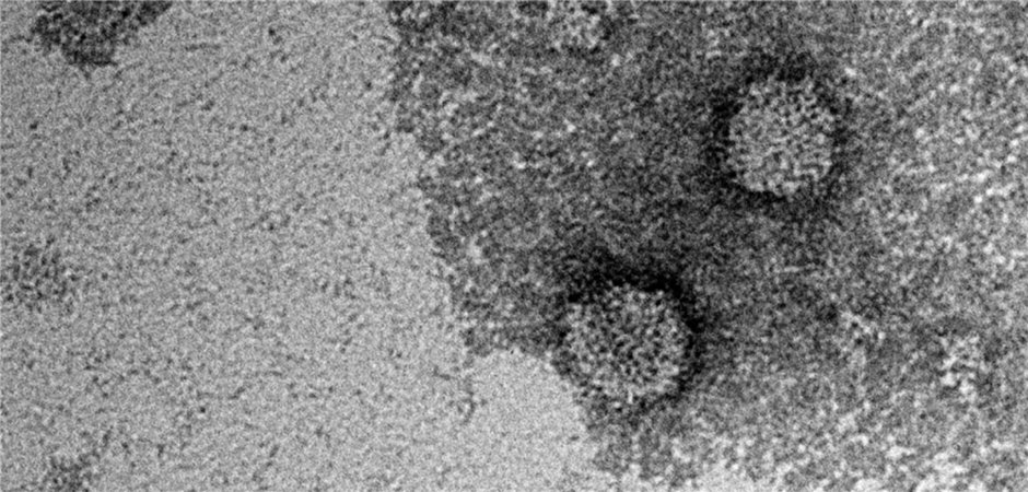 Alongshan-Viren auch in Zecken in Deutschland nachgewiesen