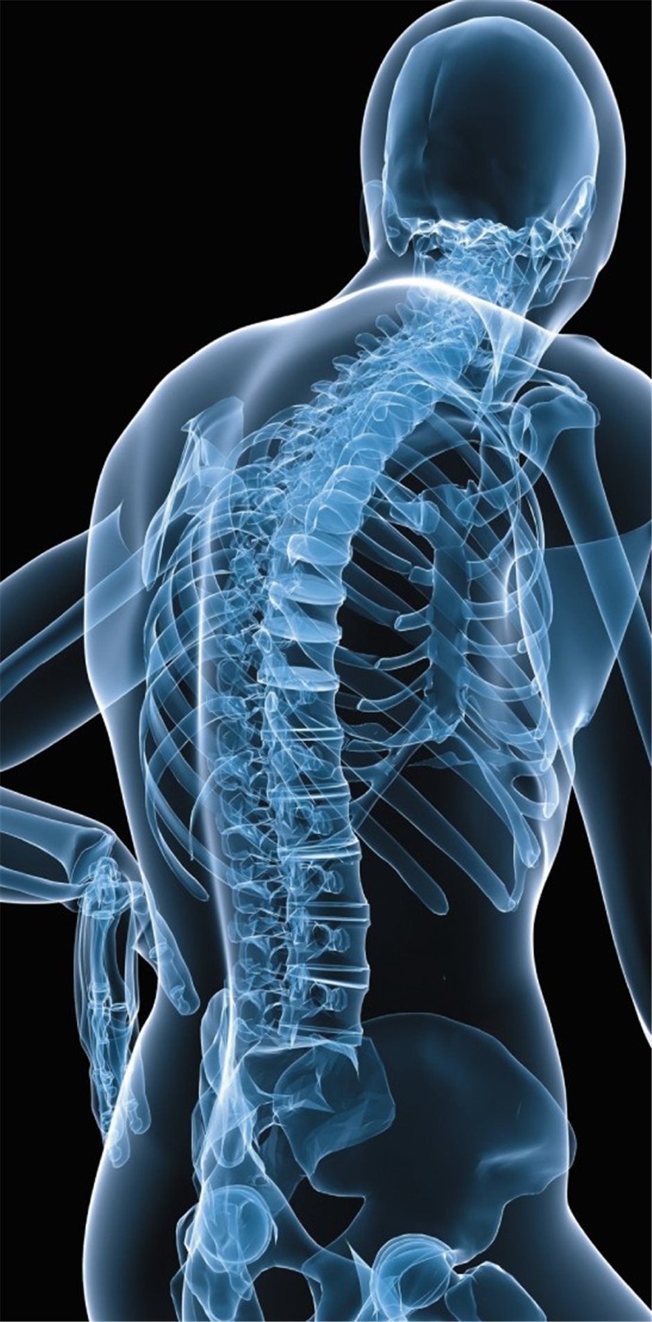 "Sieben Jahre bis zur Diagnose Bechterew"