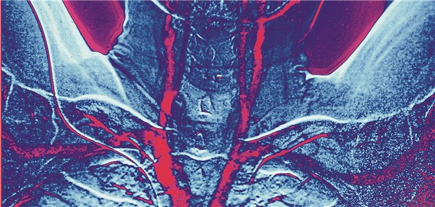 Mit Carotis-Filter auf Thromben-Fang