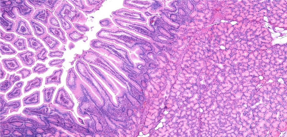 Erster Erfolg mit Transglutaminase-Hemmer bei Zöliakie